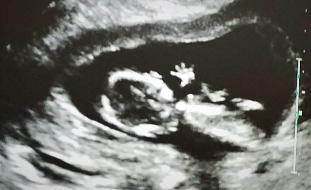 Tools for Understanding Prenatal & Postpartum Care Coordination ...